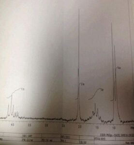 Triphenylmethanol IR Spectrum: Clearly Labeled for Easy Analysis (2025)